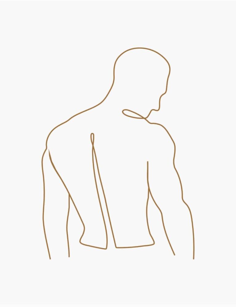 TubelessTuck Upper East Side - Drainless Tummy Tuck NYC